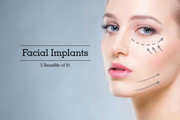 Facial Implants - 5 Benefits of It!