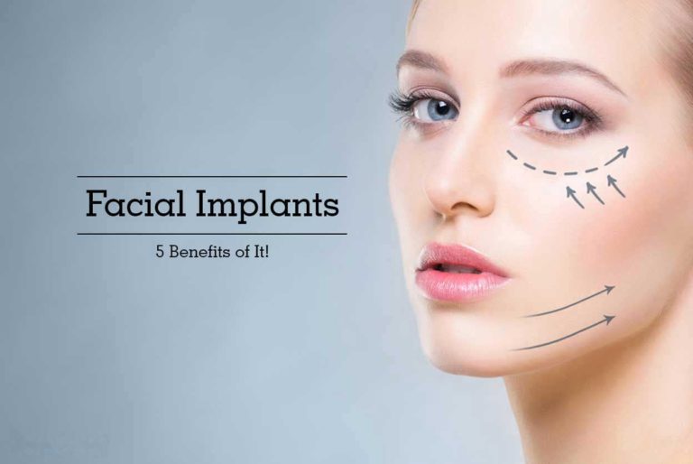 Facial Implants - 5 Benefits of It!